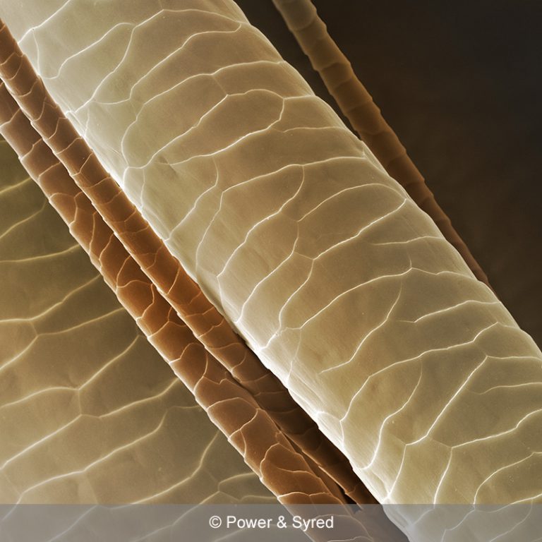 Animals - PS micrographs